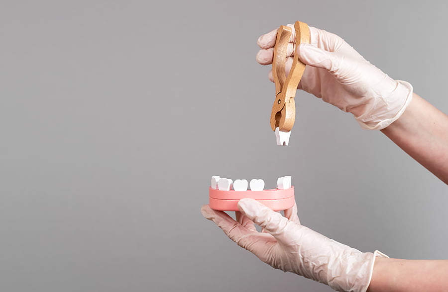 Sfaturi după extracția dentară: recomandări, alimentație și igienă ...